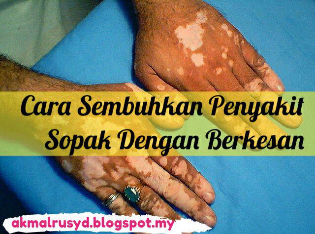 Ada Ke Cara Untuk Sembuhkan Penyakit Sopak Dengan Berkesan Dan Cepat?