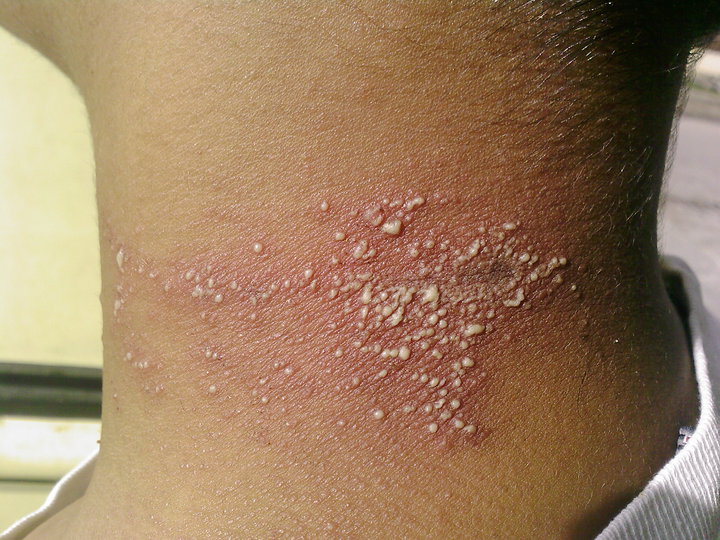 situs resmi Dara izhhar: all about tomcat a.k.a semut semai