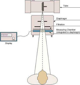 VELTCAMP: Dose area product (DAP)