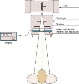 DoseWizard: Dose Area Product (DAP)