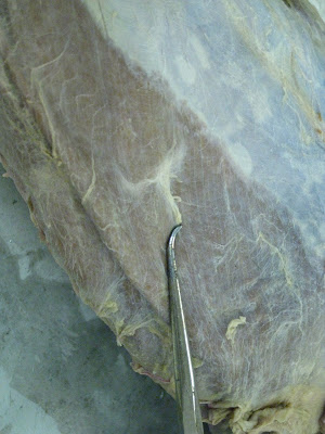 Kitty Cadaver: Cat Muscles - external oblique