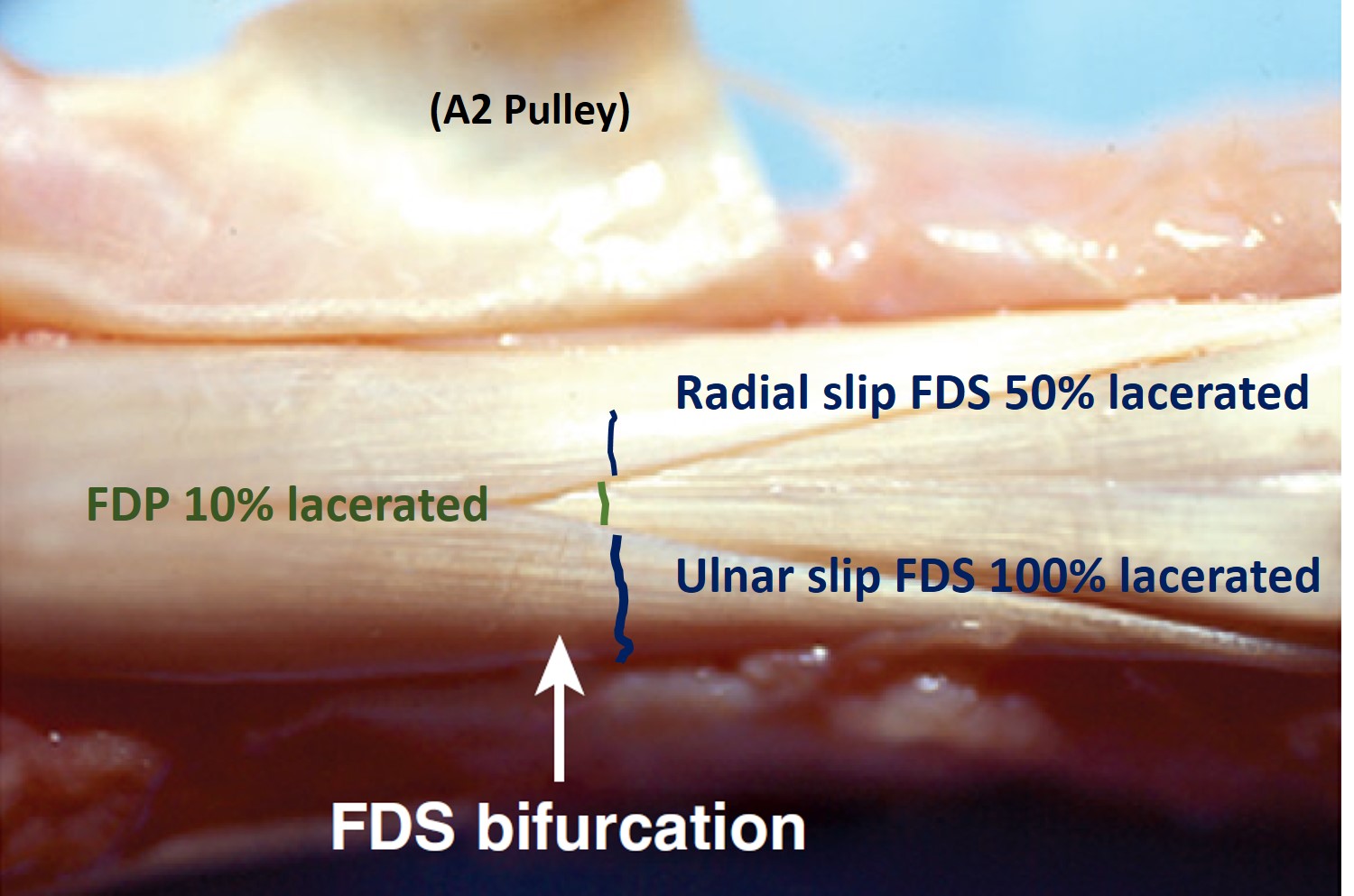 54 Degrees South: Single Handed Progress