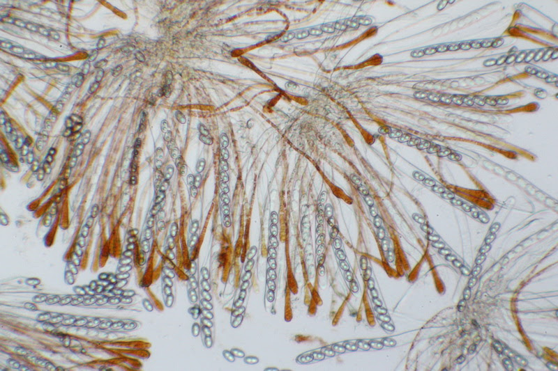 El mundo microscópico de los hongos: Ascomicetos