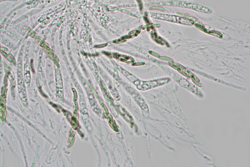 El mundo microscópico de los hongos: Ascomicetos