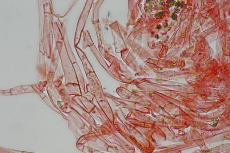 El mundo microscópico de los hongos: Gasteromicetos