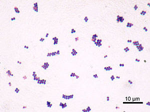 Medicina: Microbiologia - Teste de Gram