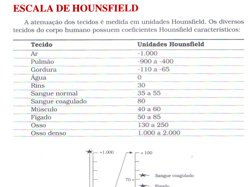 Radiologia Tecnológica: Escala de Hounsfield em TC