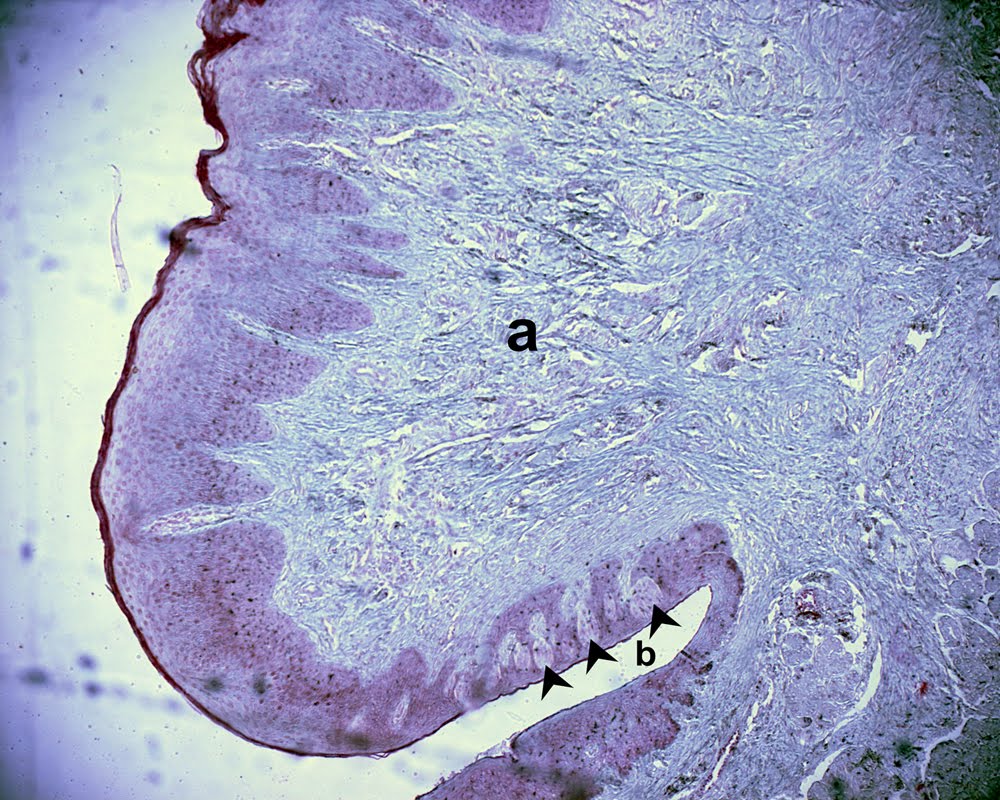 Ciências Morfológicas - UFRN: Papila Lingual