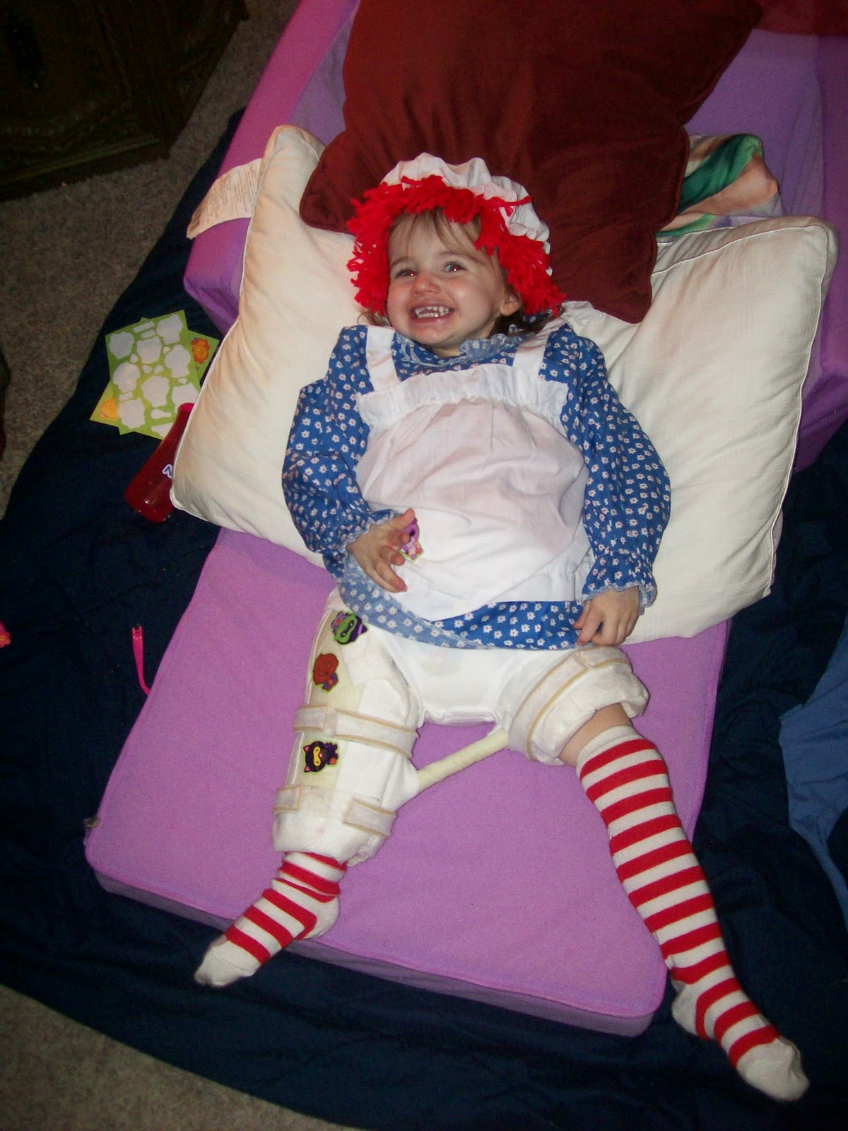 Madi's Milestones with PFFD: Amazed!