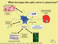 Glaucoma: Neuroprotection in Glaucoma