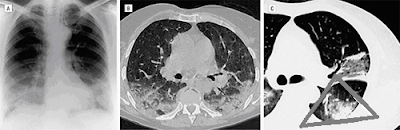 February 2009 - icuroom