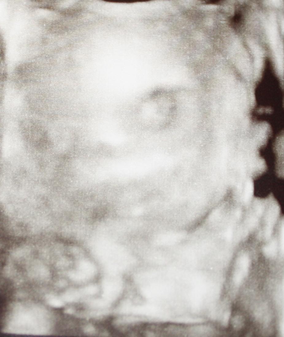 Carter's Journey: OEIS complex