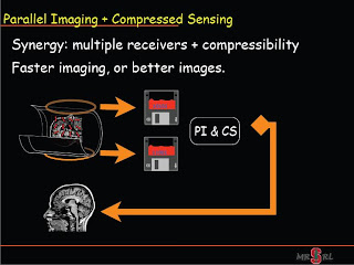 Nuit Blanche: CS: Combining Parallel Imaging and Compressed Sensing, A ...
