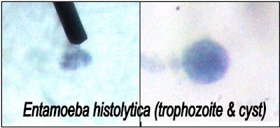 Invertebrate Zoology: Amoebozoa & Cercozoa