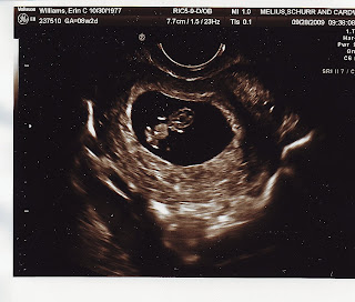 Williams' Pregnancy: Week 9 ultrasound pics