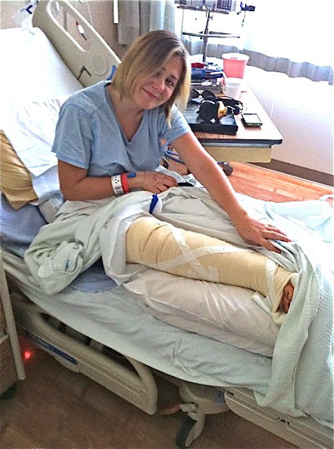 The Style Spook: I Broke My Leg