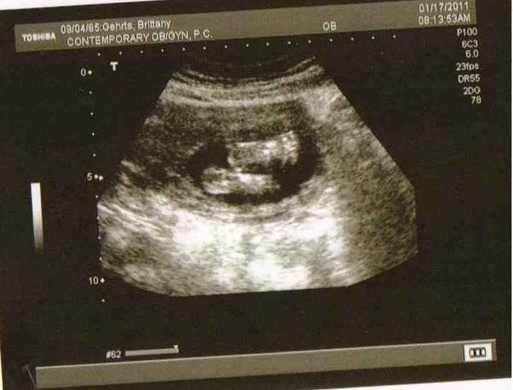 From Bump to Birth: 22 Weeks: Its a boy!!