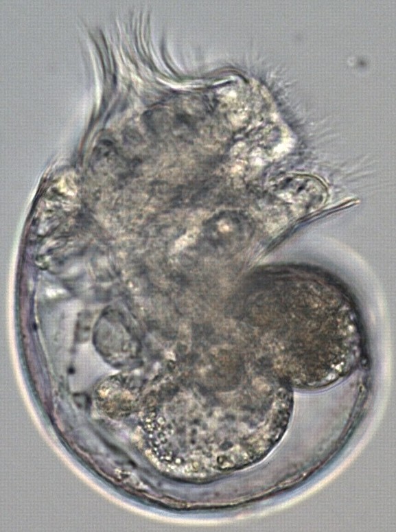 Invertebrate Embryology: Nudibranch veliger larva