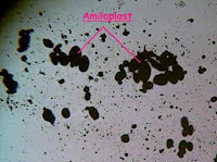 Química de Alimentos: El almidón
