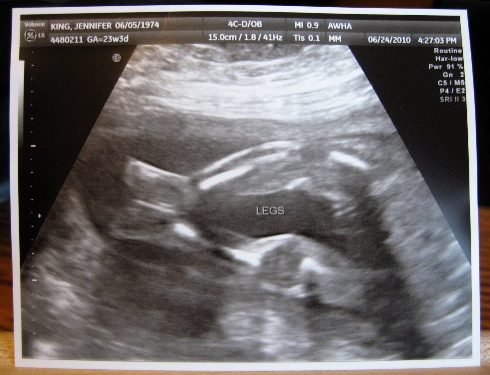 Lookie What I Can Do!!: 23 week ultrasound in 3-D!