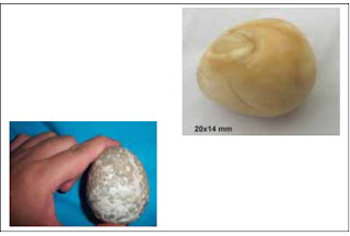 Gajamuktha: Rare Ivory: The Elephant Pearl