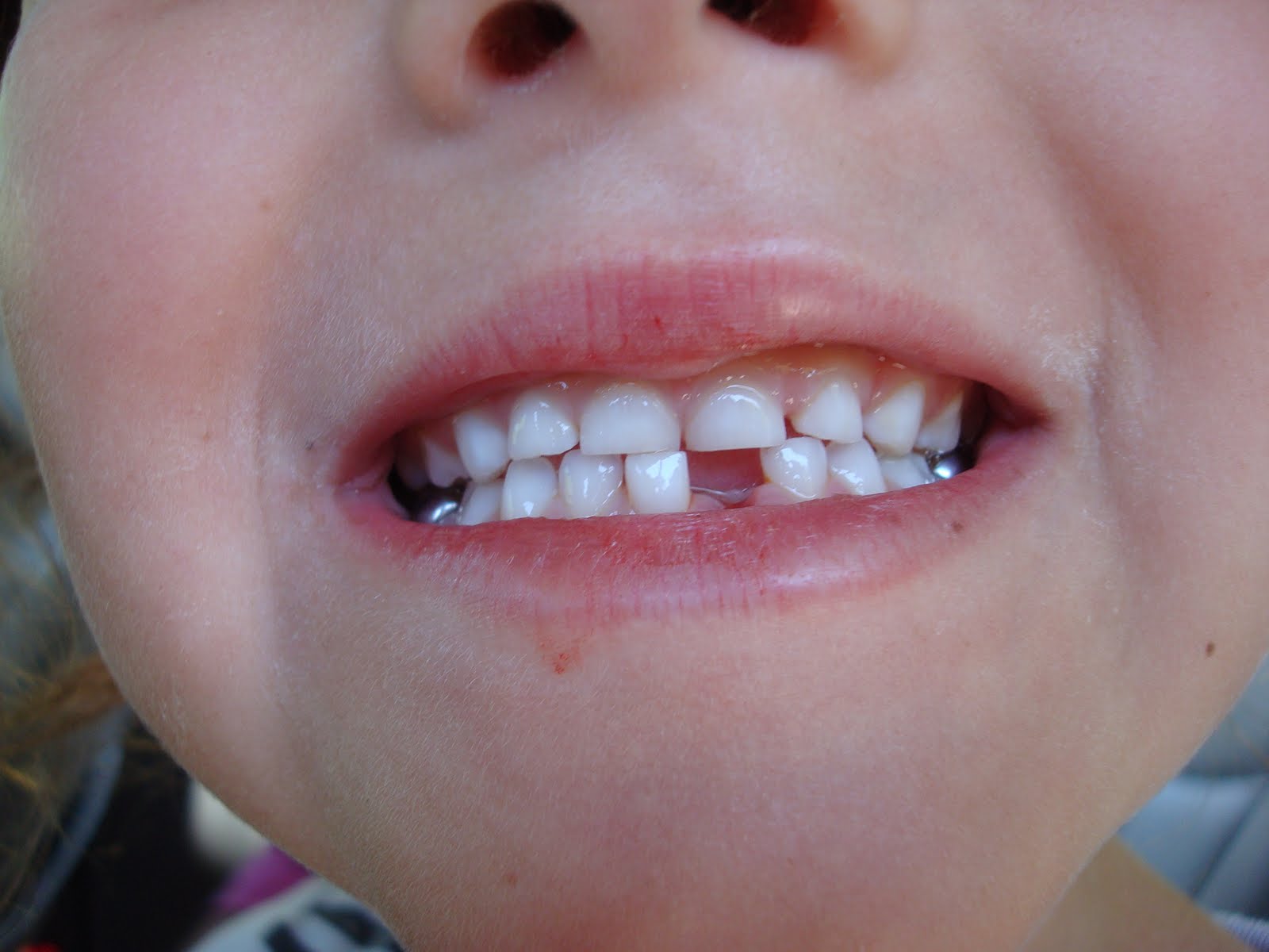 Poprocks and Goblins: One Little Lost Tooth, Part 1