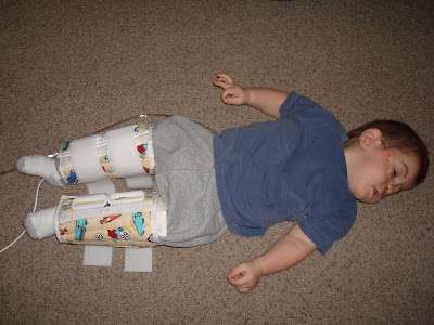 Kinnick Kay and Carver Lee: Carver's Pedi Wraps - What a big help!