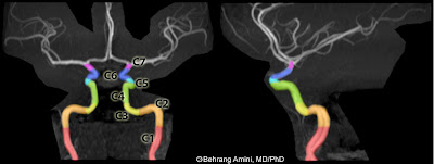 Roentgen Ray Reader: Segments of the Internal Carotid Artery