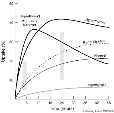 Roentgen Ray Reader: Thyroid Radioiodide Uptake (RAIU) Curves