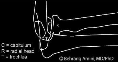 Roentgen Ray Reader: The Radial Head—Capitulum View