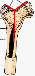 I Heart Medical Mnemonics: Bony Metastasis