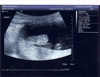 Introducing... Connor William Rozar!: 19 Weeks - 3D Ultrasound