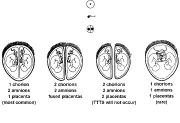 I Don't Share Popcorn: My Mono/Dis