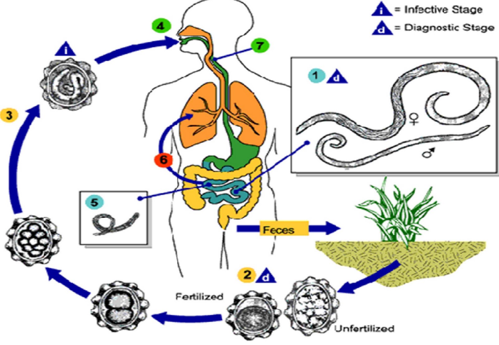 Ascariasis Lumbricoides