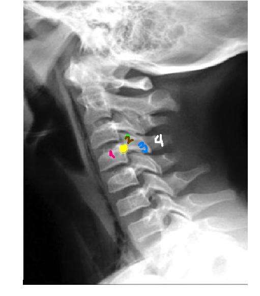Anatomía UNAM: Rx de Columna cervical proyección lateral
