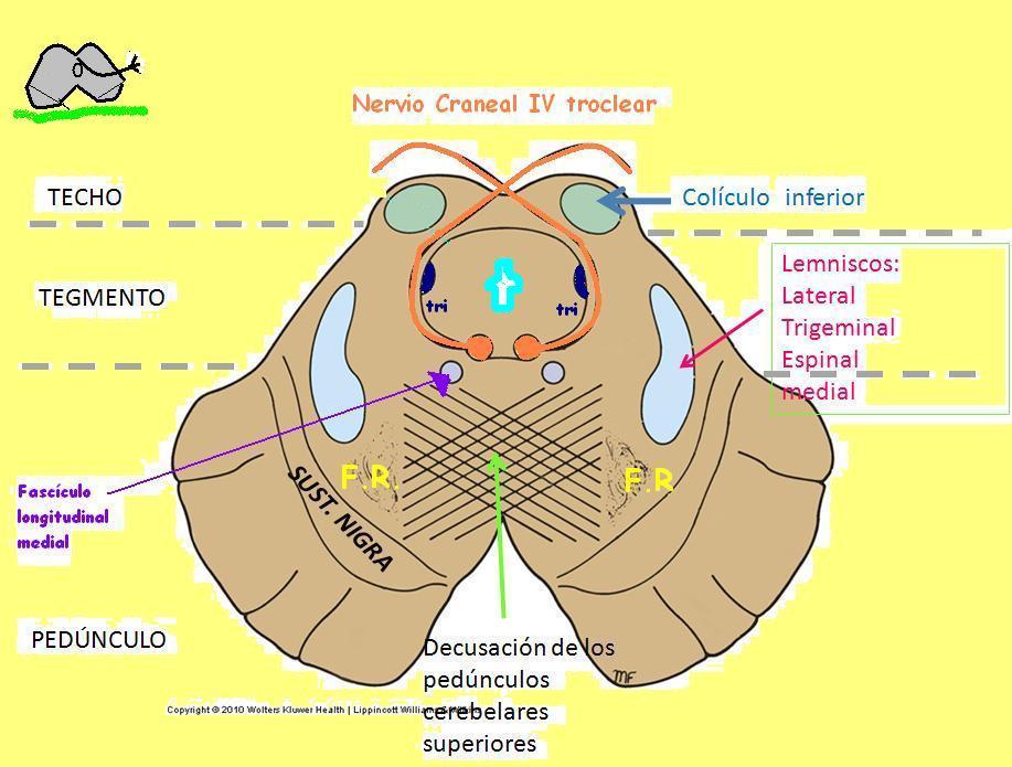 PPT - Conformación Externa e Interna de Tallo Encefálico. PowerPoint ...