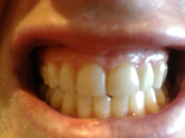 Group N "Body Modification": Maleya: Cosmetic Dentistry: Phase One