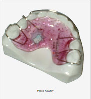 Nucleo de Prótese Dentária da ESSVS - Escola Superior de Saúde do Vale ...