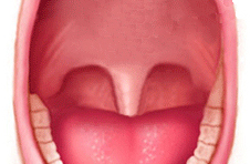 New Video on Uvula Excision for Snoring (and Other Problems) | Fauquier ...