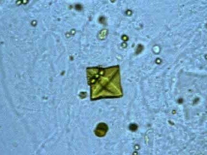 Laboratorio Clinico: CRISTALES DE OXALATO DE CALCIO