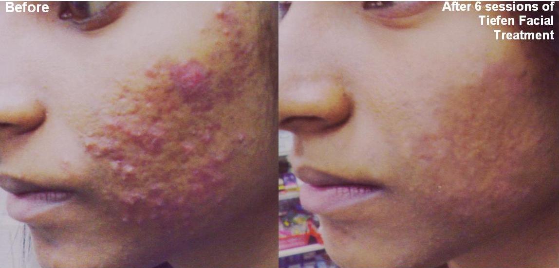 SkyLab Beauty & Wellness: Hear what my customers got to say?