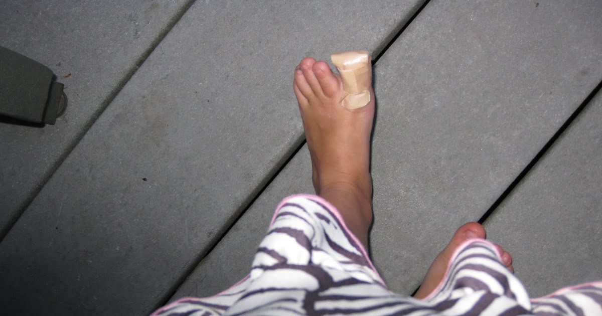More Of The Howe Girls Stubbed Toe