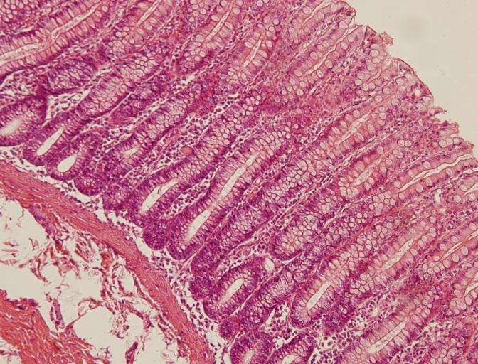 Histologia dos Sistemas: Intestino Grosso
