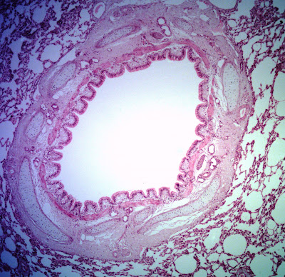 Morfologia: Pulmão - Brônquio intra-pulmonar