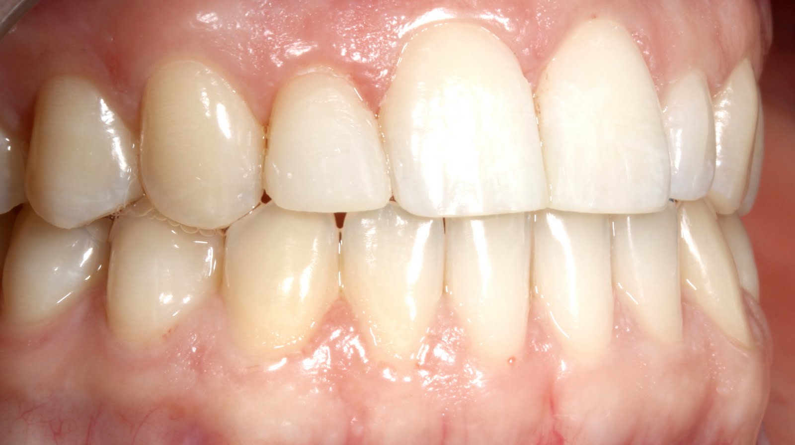 Zahnarzt Bochum Herne: 09.06.2010