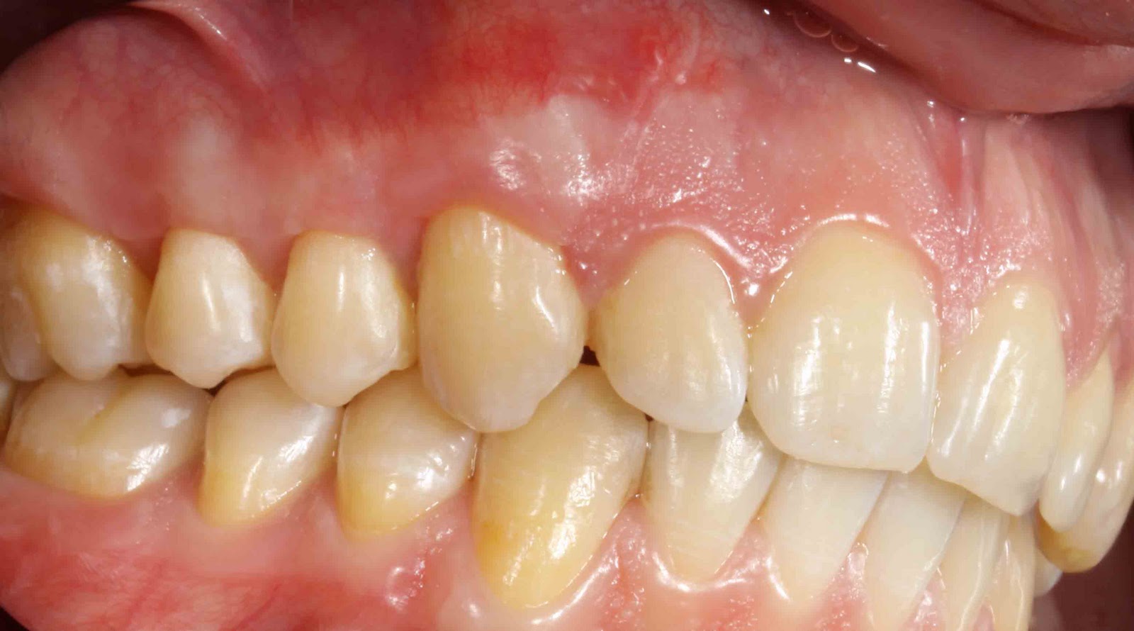 Parodontologie Bochum: Februar 2011