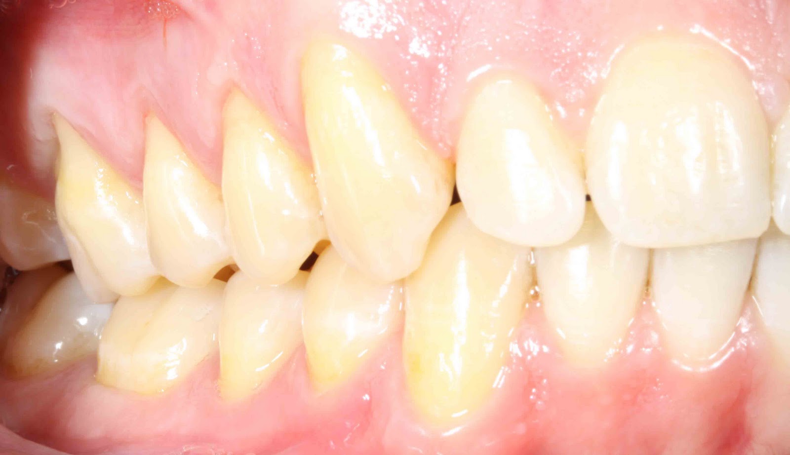 Parodontologie Bochum: Parodontologie/ Parodontosebehandlung in Bochum ...