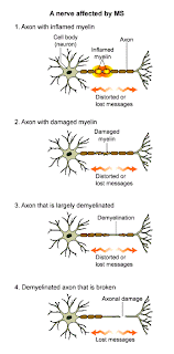 Al Fin: Re-Myelinating Neurons and Innervating Prostheses