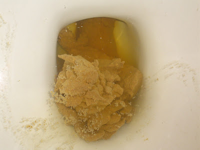 The Poop Log: 2 day old poo