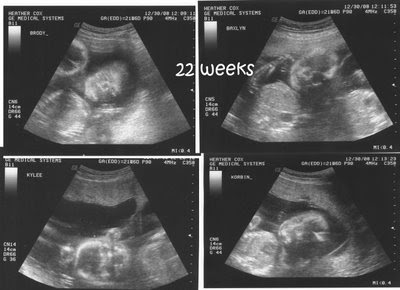 The Cox Quads: 22 Weeks!